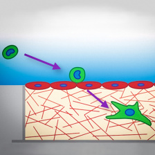 Metastasis | Koch Institute